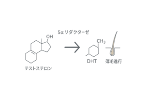 テストステロンの性欲への影響と対策｜男性機能の維持 | 薄毛（AGA）の原因・検査ならAGAメディカルケアクリニック