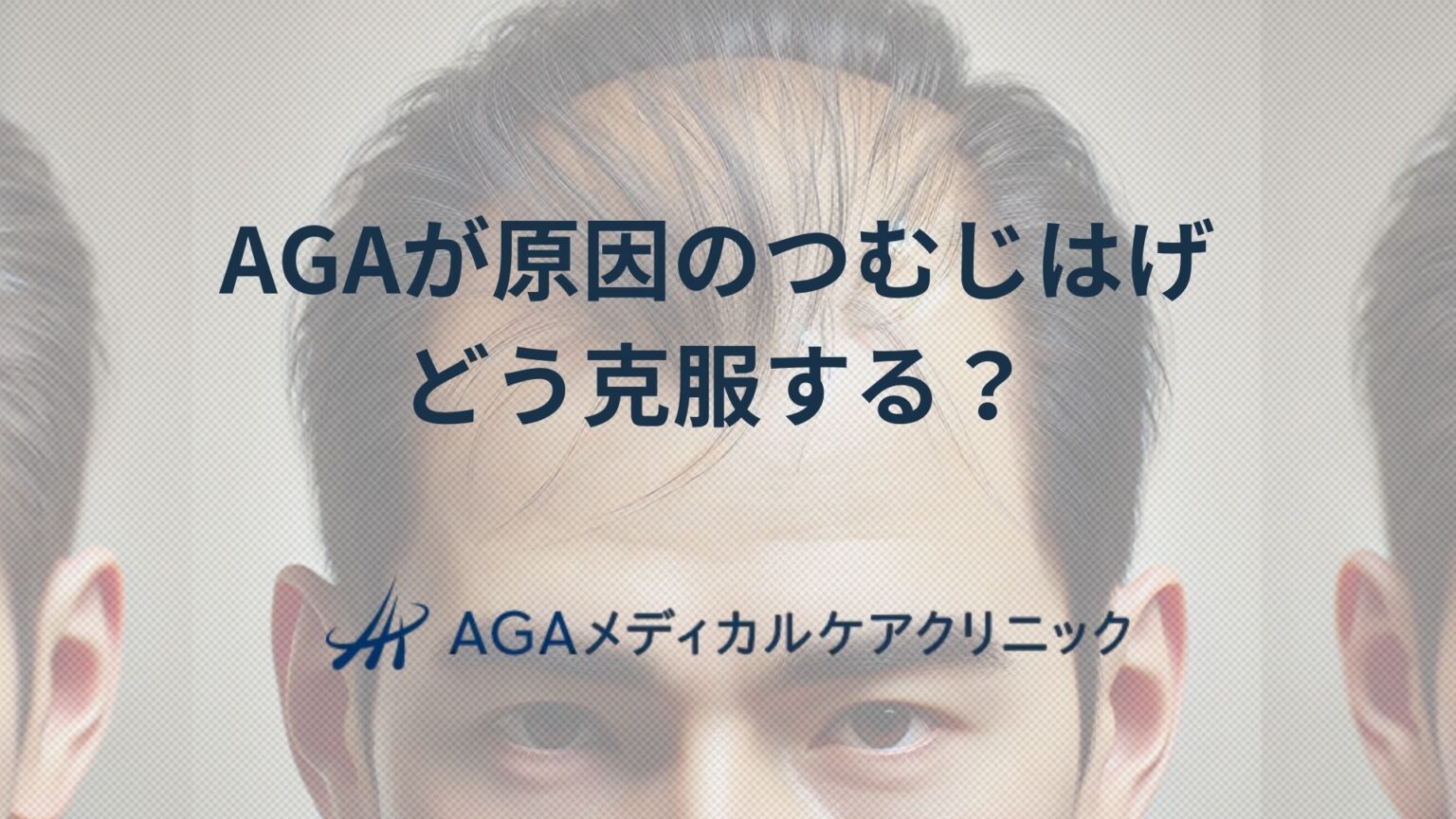 AGAが原因のつむじはげをどう克服する？頭頂部薄毛の対策と改善方法 | AGA・抜け毛・薄毛治療のAGAメディカルケアクリニック【公式】