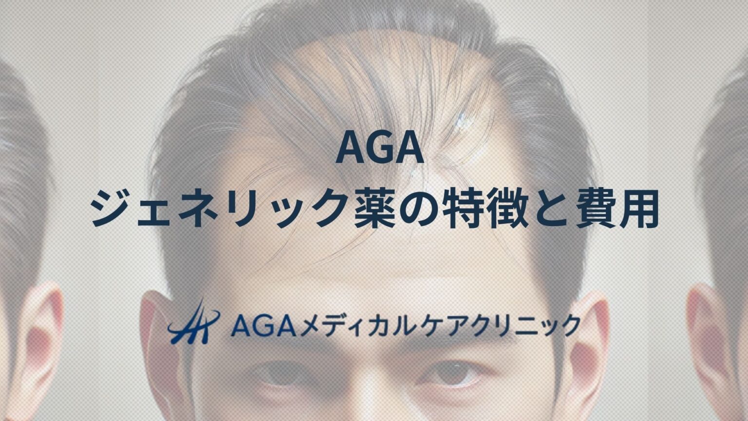 AGA ジェネリック薬の特徴と費用 フィナステリドで取り組む薄毛対策 | AGA・抜け毛・薄毛治療のAGAメディカルケアクリニック【公式】