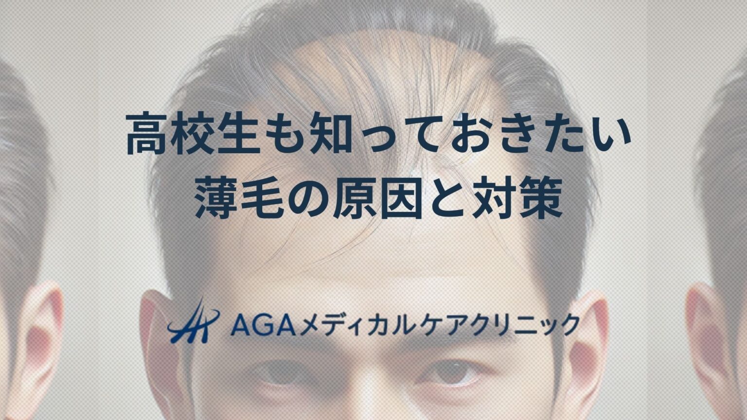 高校生も知っておきたい薄毛の原因と対策 | AGA・抜け毛・薄毛治療のAGAメディカルケアクリニック【公式】