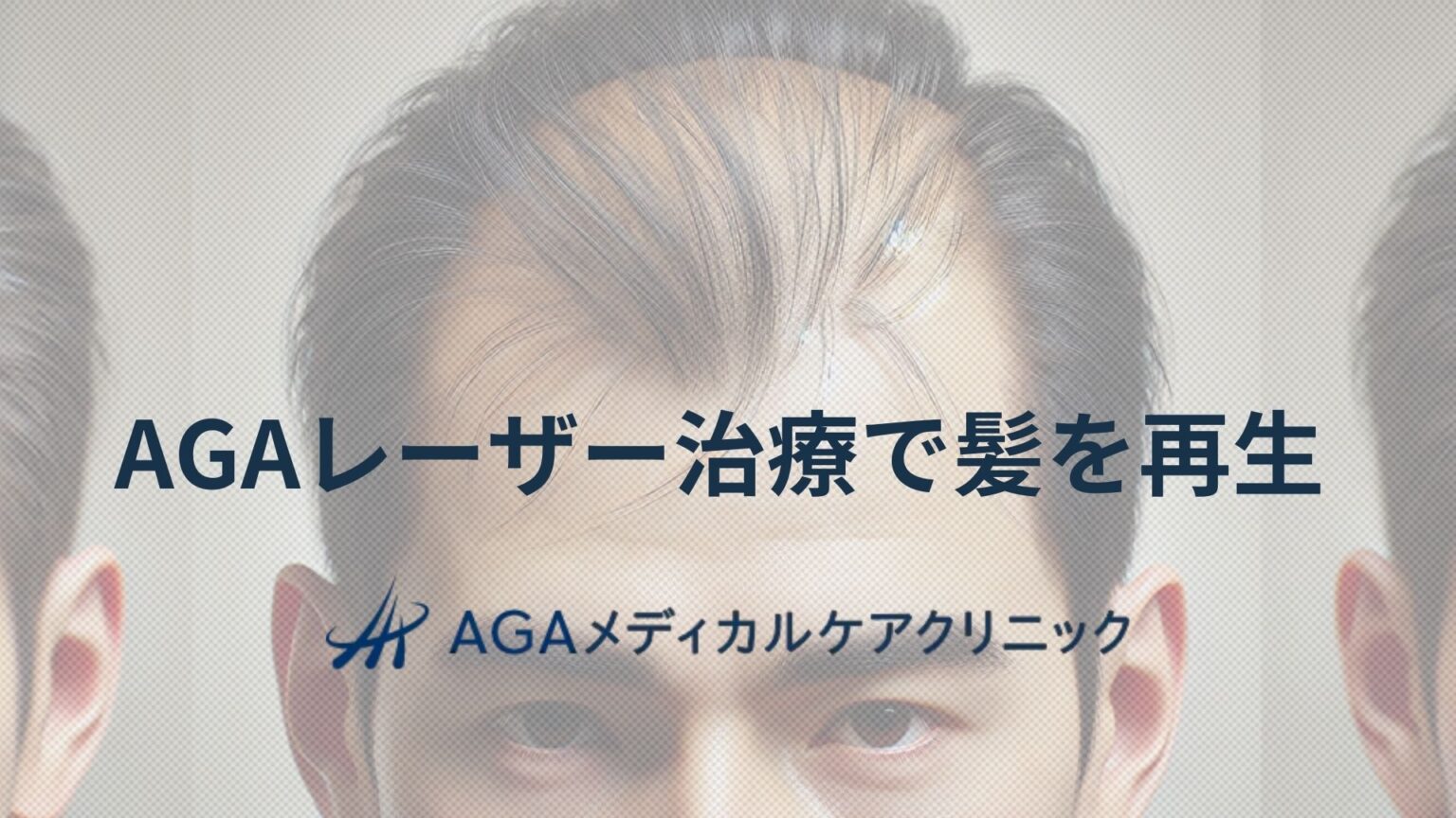 AGAレーザー治療で髪を再生 薄毛克服のためのクリニック活用術 | AGA・抜け毛・薄毛治療のAGAメディカルケアクリニック【公式】
