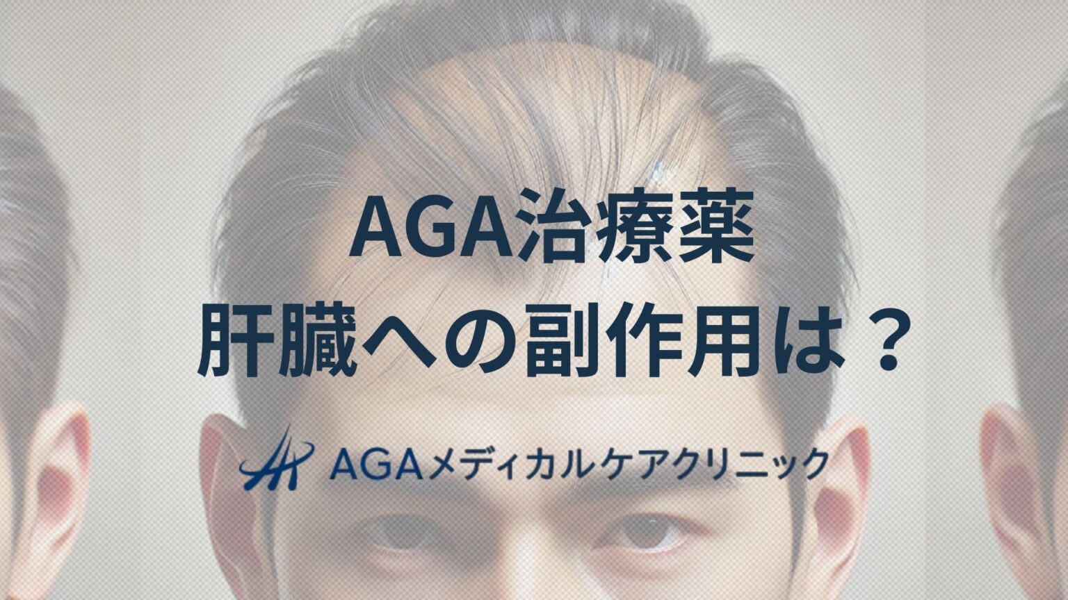 AGA治療薬 肝臓への副作用と安全に進めるコツ | AGA・抜け毛・薄毛治療のAGAメディカルケアクリニック【公式】