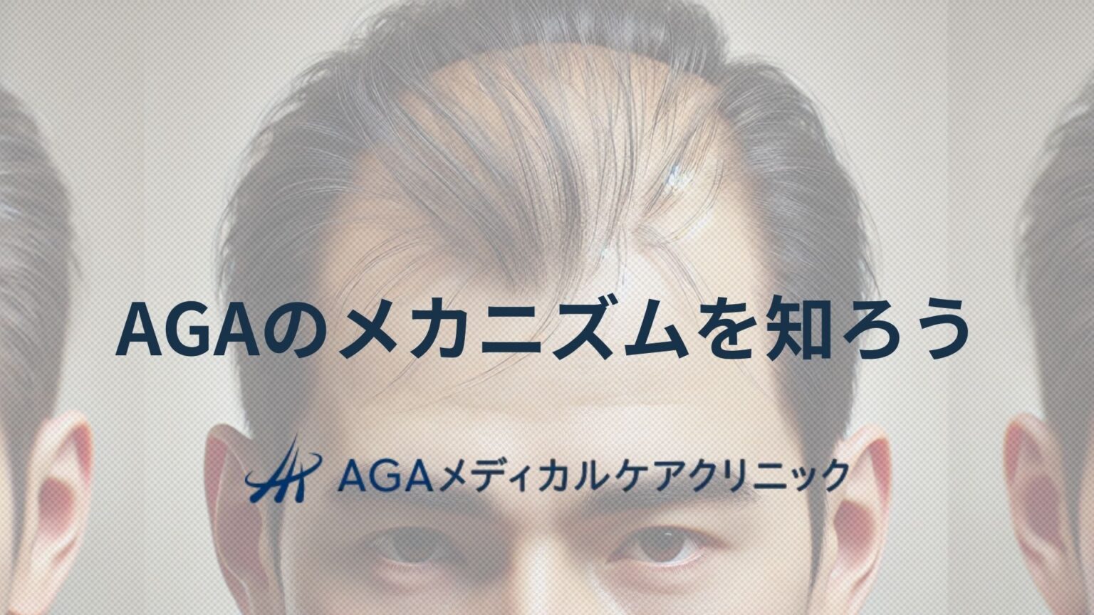 AGAのメカニズムを知り薄毛の原因と治療方法を考える | AGA・抜け毛・薄毛治療のAGAメディカルケアクリニック【公式】