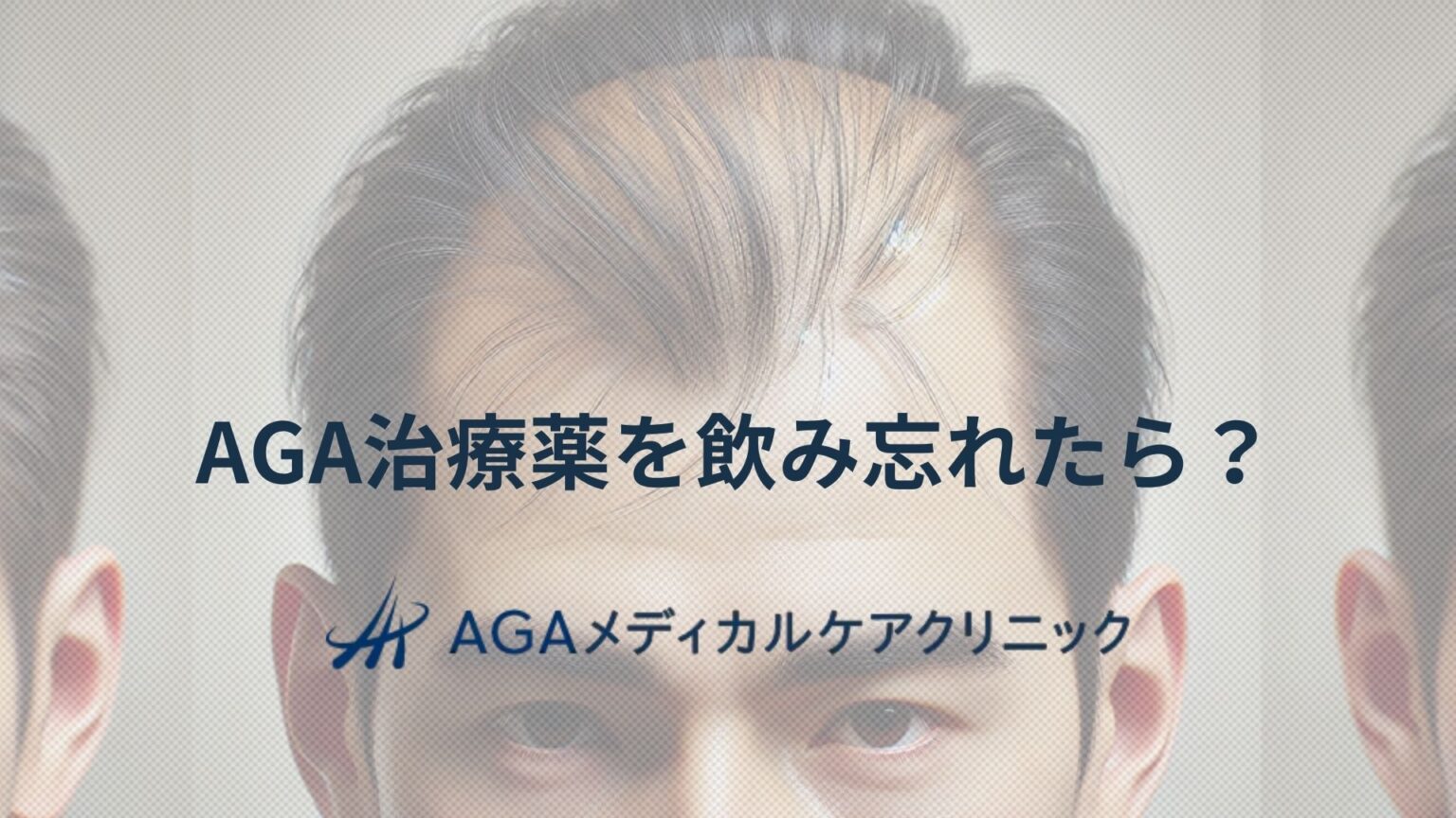 AGA治療の薬を飲み忘れたらどうする？ | AGA・抜け毛・薄毛治療のAGAメディカルケアクリニック【公式】
