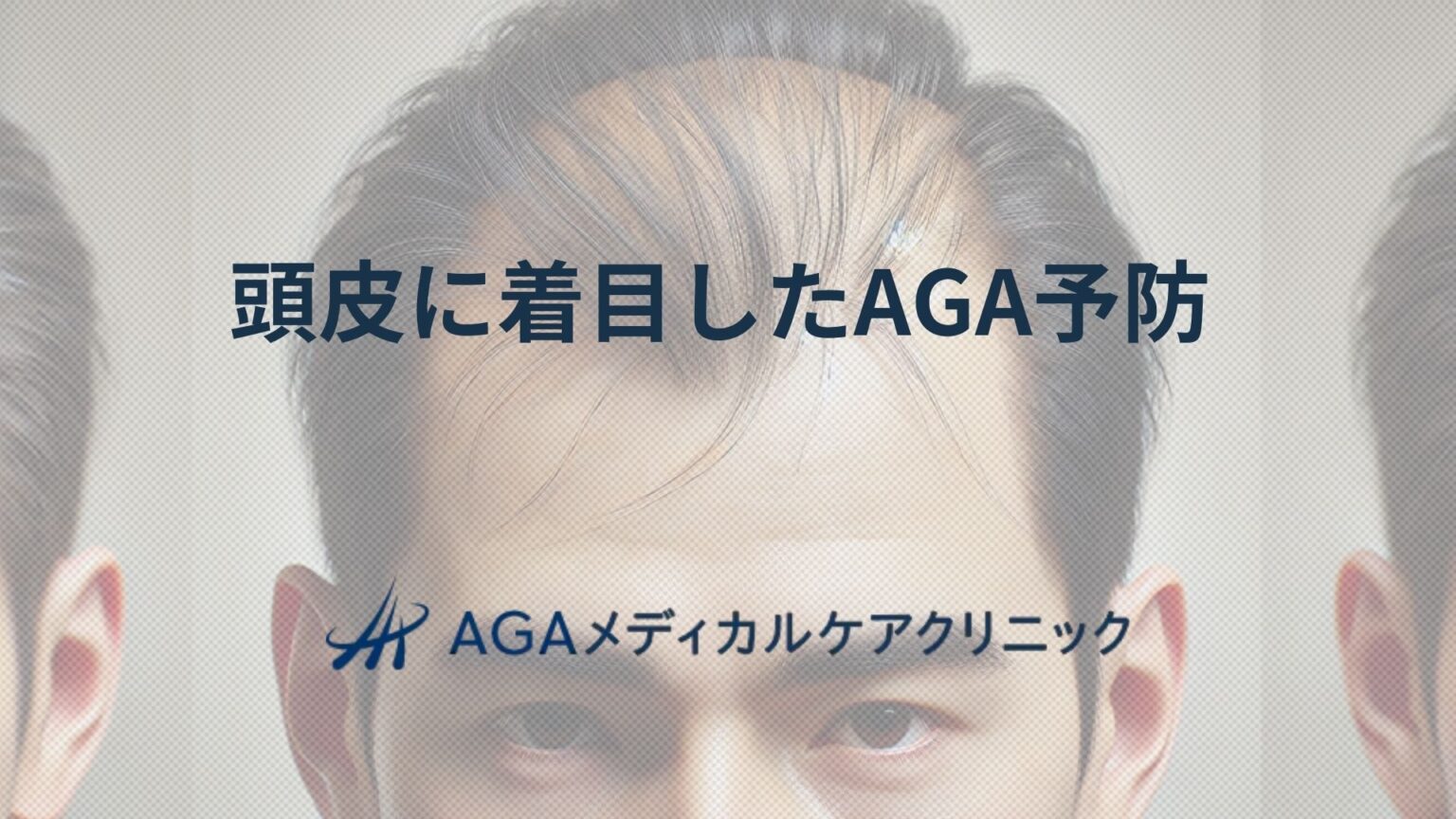 AGA 頭皮を守って薄毛リスクを減らすには | AGA・抜け毛・薄毛治療のAGAメディカルケアクリニック【公式】